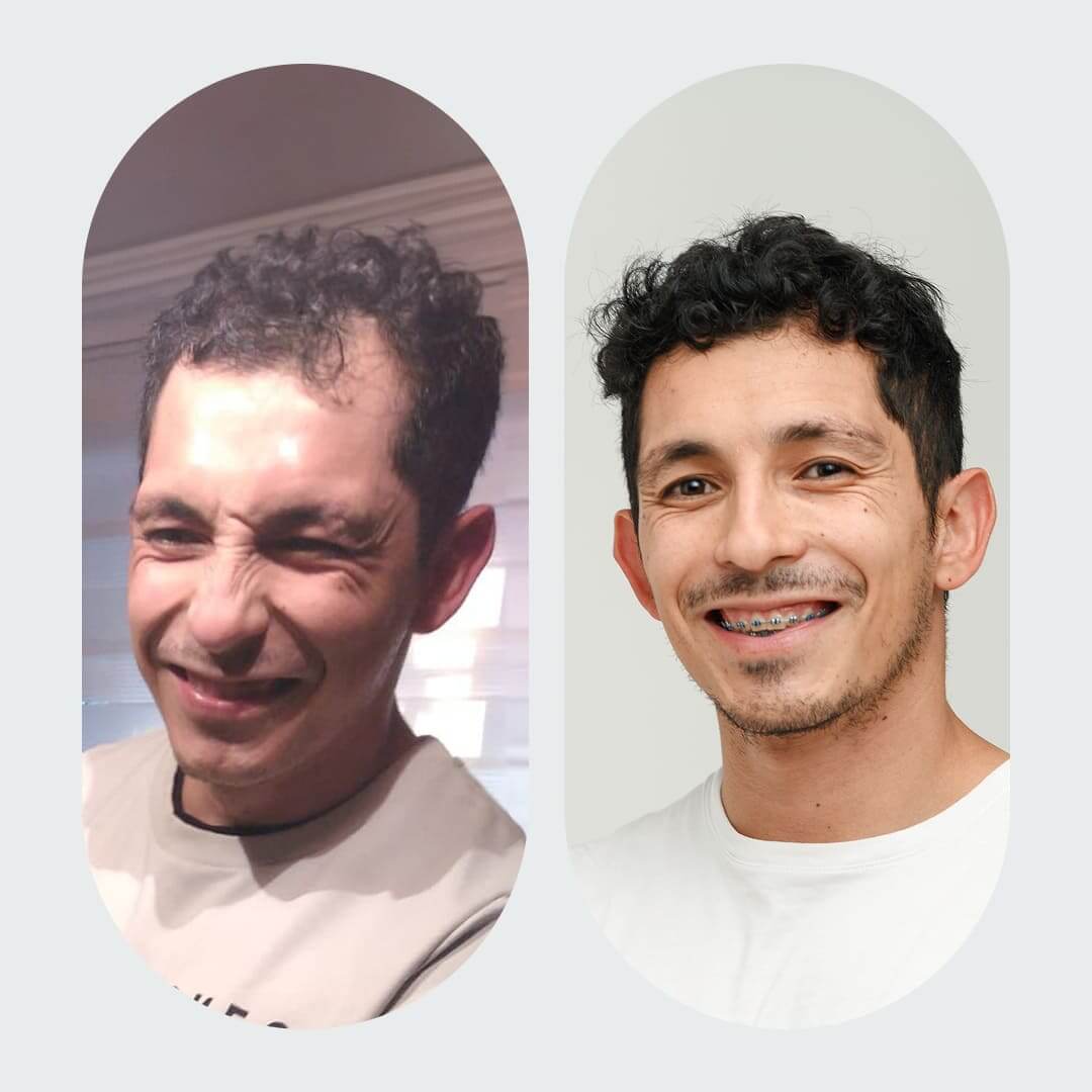 🧬 Tónico capilar fortificante con Células madre y Ácido Hialurónico – ILEV Routine