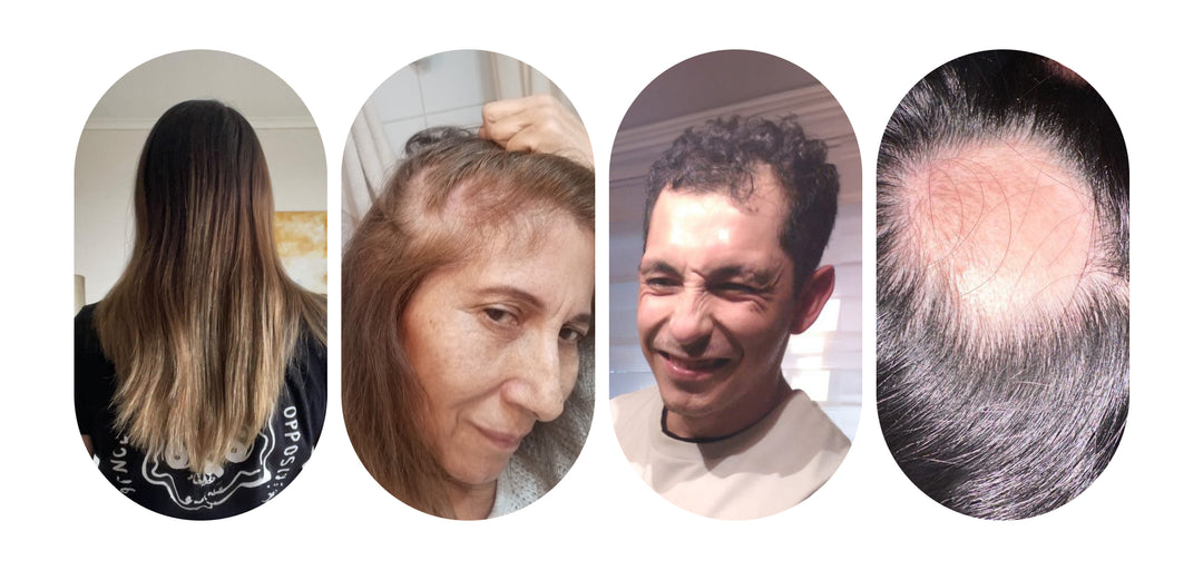 🧬 Tónico capilar fortificante con Células madre y Ácido Hialurónico – ILEV Routine