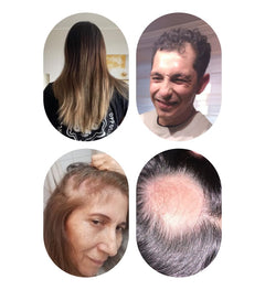 🧬 Tónico capilar fortificante con Células madre y Ácido Hialurónico – ILEV Routine