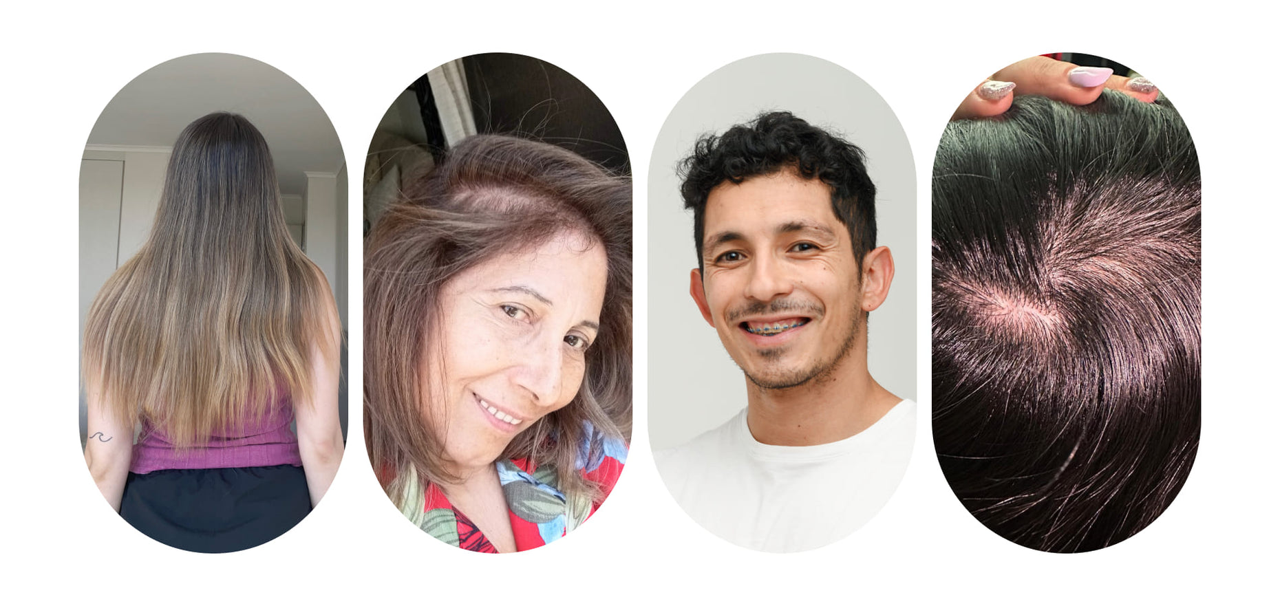 🧬 Tónico capilar fortificante con Células madre y Ácido Hialurónico – ILEV Routine