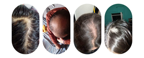 🧬 Tónico capilar fortificante con Células madre y Ácido Hialurónico – ILEV Routine