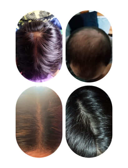 🧬 Tónico capilar fortificante con Células madre y Ácido Hialurónico – ILEV Routine