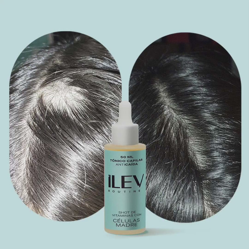 🧬 Tónico capilar fortificante con Células madre y Ácido Hialurónico – ILEV Routine - Daniela ...